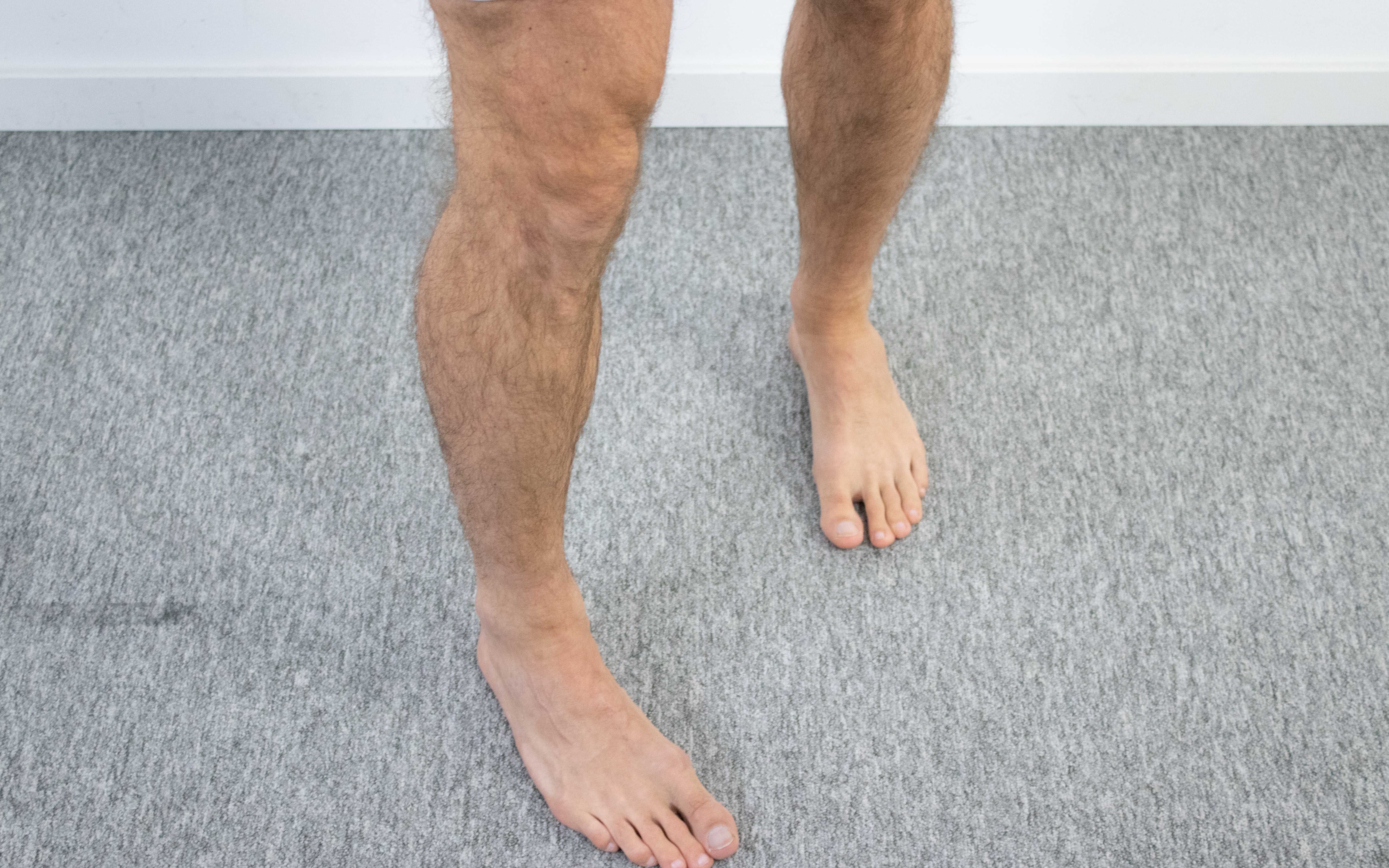 Gangtest med fodprogressionsvinkel | FAI-vurdering af hoften