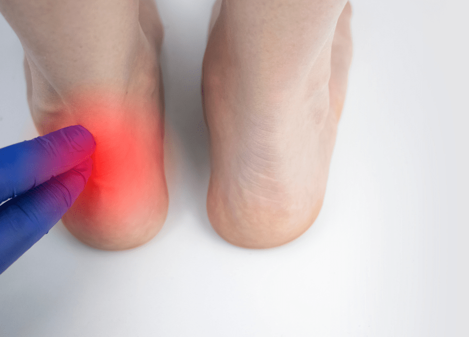 Episodio 020: Tendinopatía 101 con Jill Cook - Fisiotutores