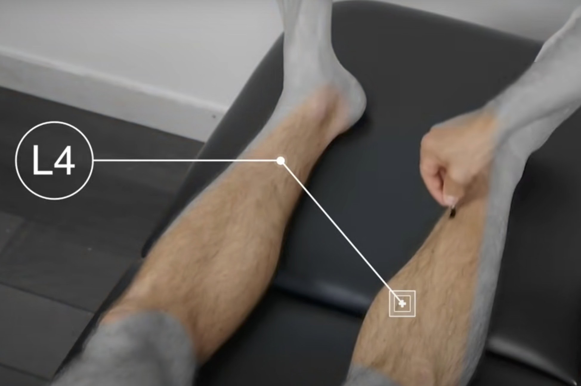 Prueba del dermatoma L4 - Physiotutors