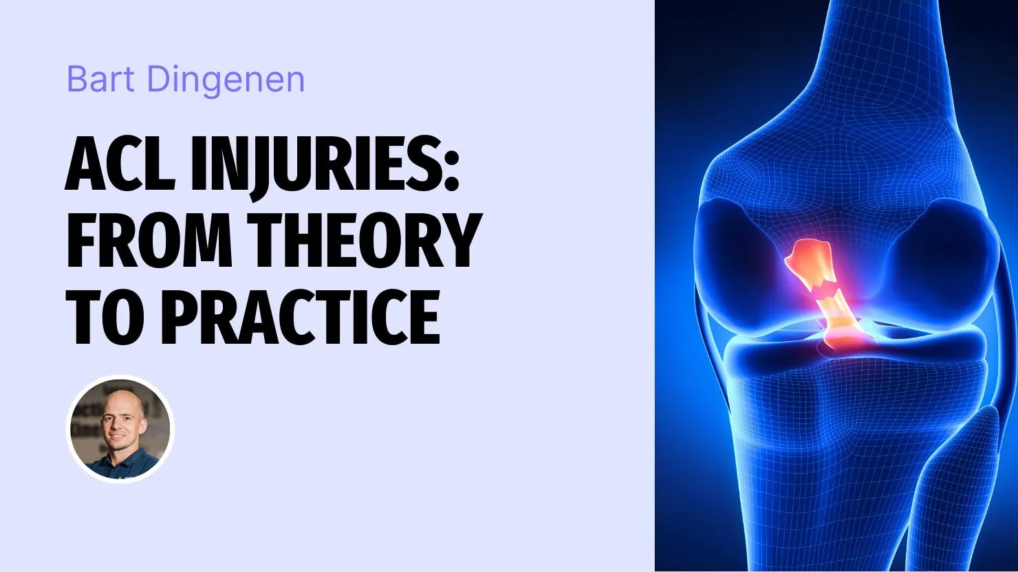 Cours de physiothérapie sur les blessures du LCA | Formation en ligne ...