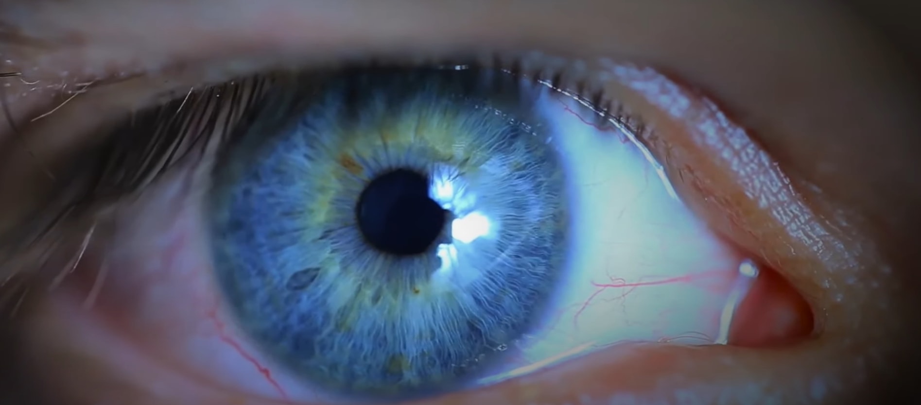 Nerf oculomoteur | Nerf crânien III / CN III Évaluation