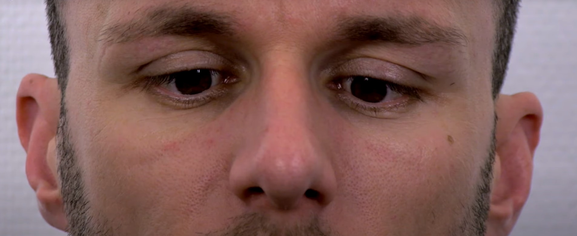 Évaluation du nerf trochléaire - nerf crânien IV / CN IV