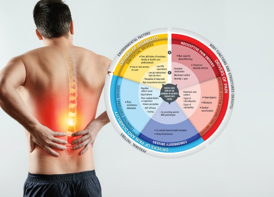 Modèle de lombalgie PDDM | Yannick Tousignant-Laflamme