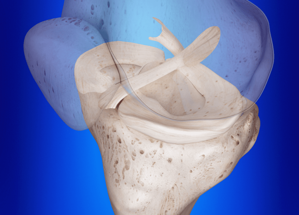 Protokol rehabilitasi ACLR yang dipercepat | Dapatkah kita mempercepat ...