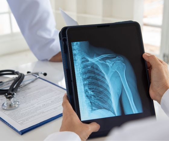 Rehabilitasi untuk Dislokasi Bahu Anterior - Fisioterapis