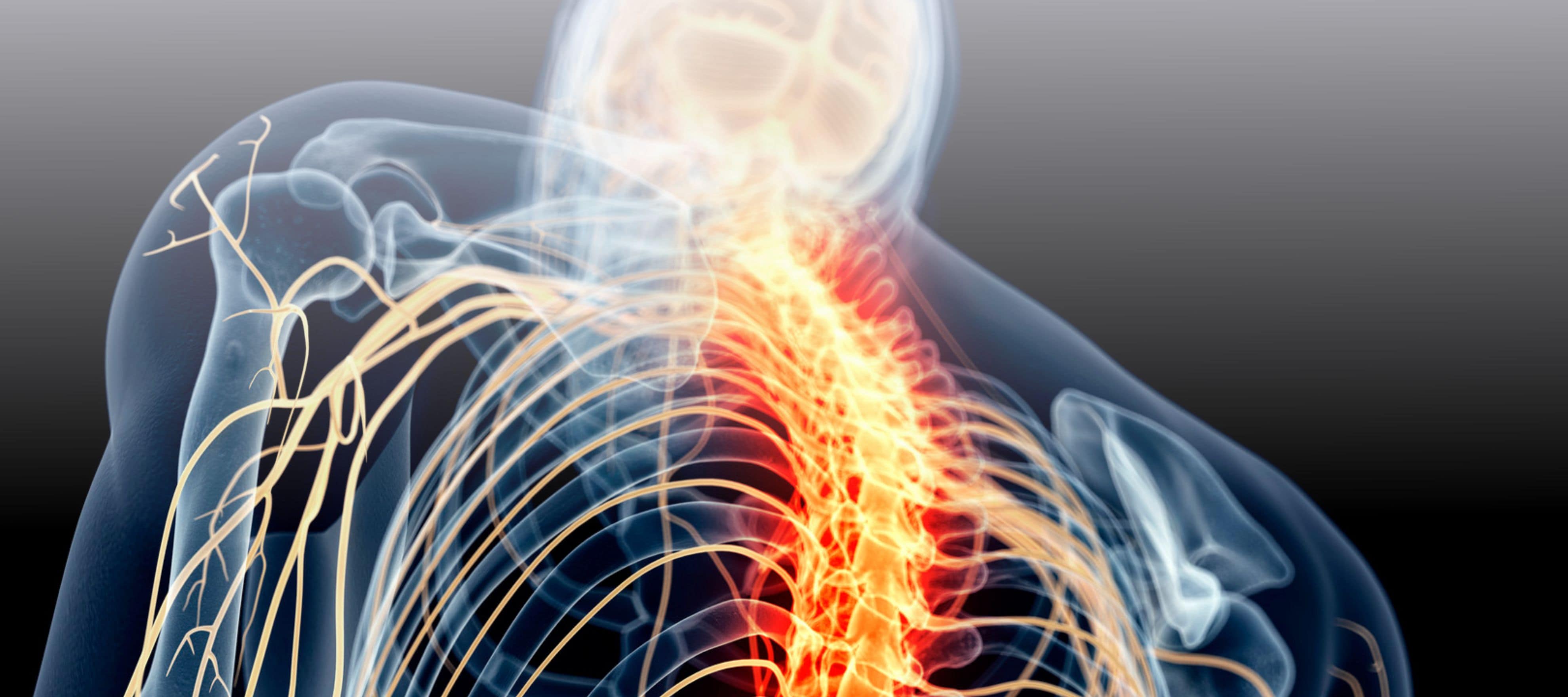 Centrale sensitisatie bij chronische pijn | Masterclass door Jo Nijs