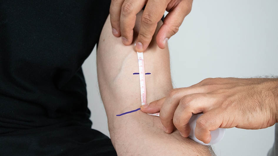 Intervalul de încrețire a bicepsului | Evaluarea ruperii tendonului ...