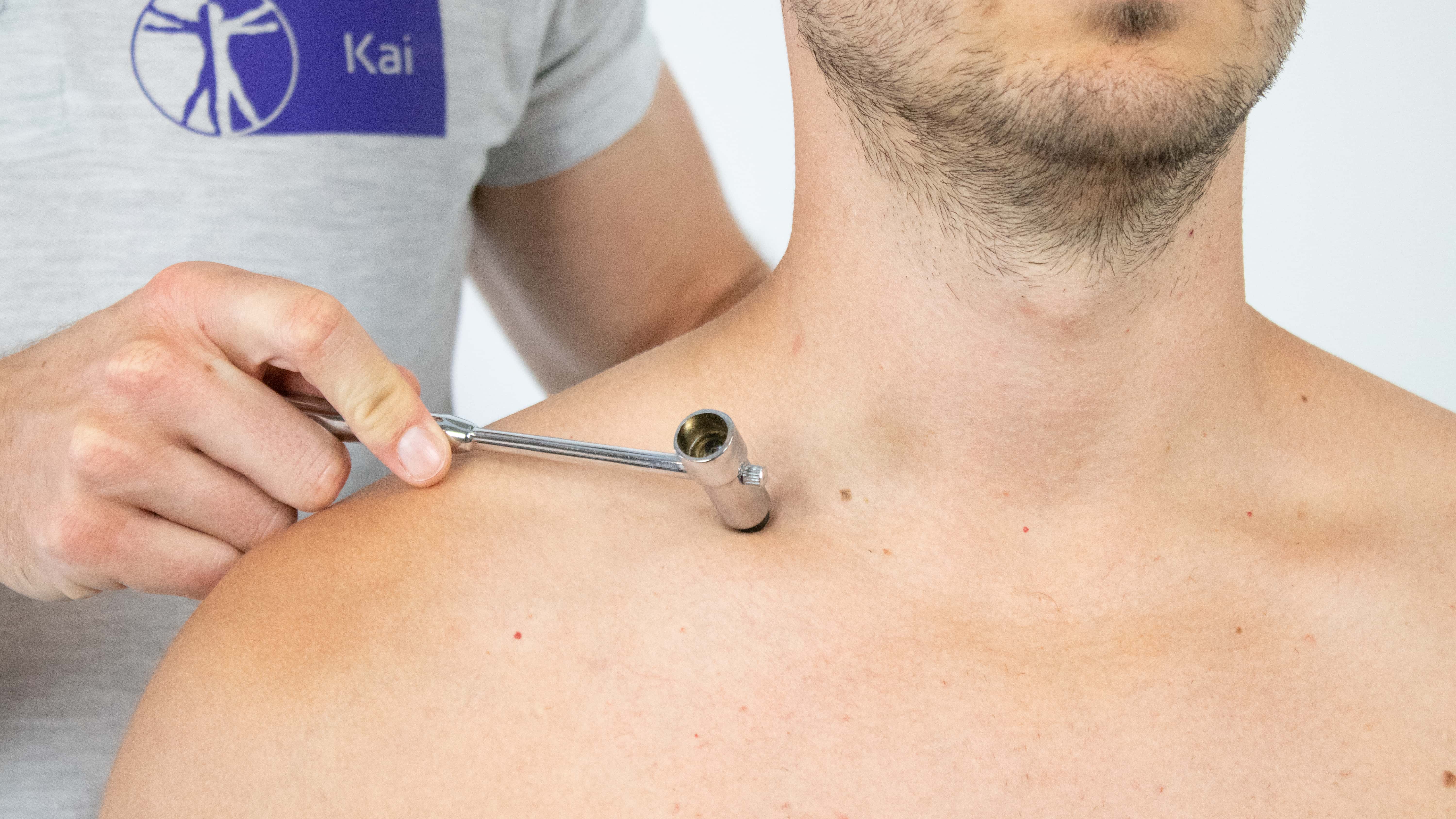 Tinelov znak za TOS | Thoracic Outlet Syndrome Assessment