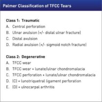 Fovea Sign | Triangular Fibrocartilage Complex (TFCC) Exam