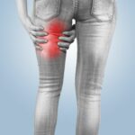 Proximal Hamstring Tendinopathy | Diagnosis & Physio Treatment