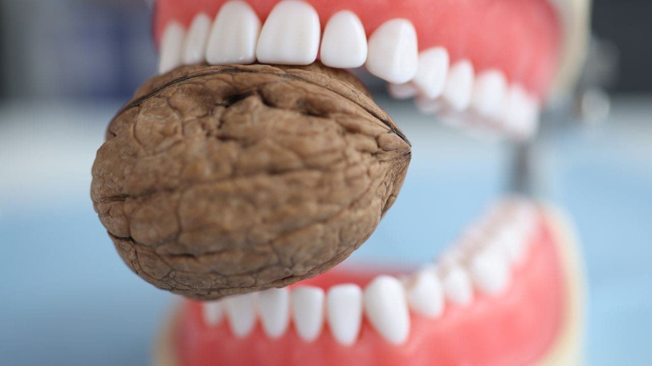 Temporomandibular Disorders (TMD): A Comprehensive Overview